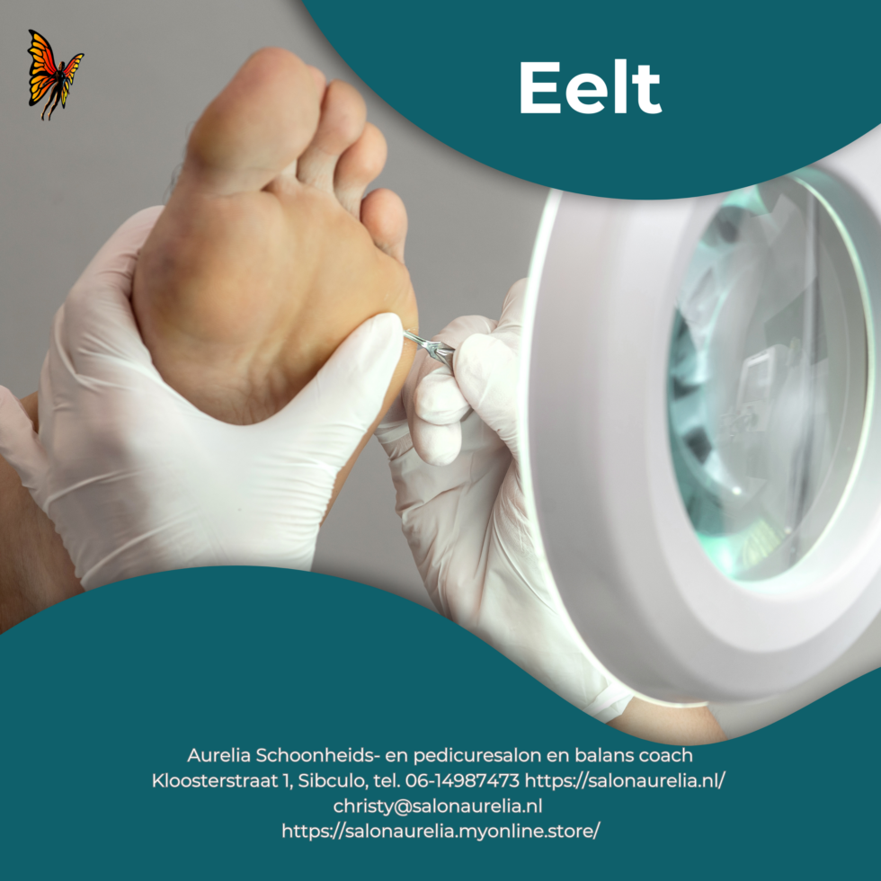 Wat is eelt? Hoe ontstaat het? Hoe kom je er vanaf? | Salon Aurelia